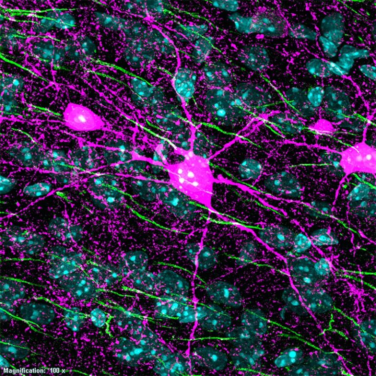 Neurociencia Celular: Explorando el Cerebro | iNeurociencias