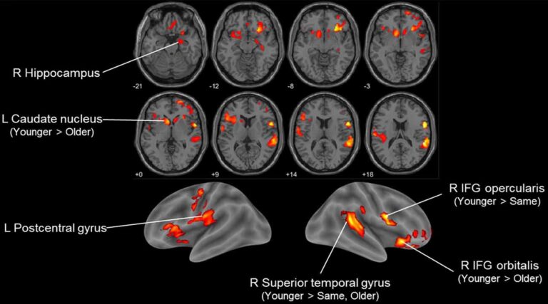 El Cerebro al Envejecer: Neurobiología | iNeurociencias