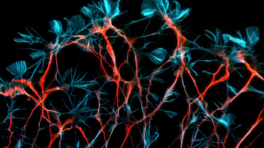 Alta Demanda en Neurociencia Computacional | iNeurociencias
