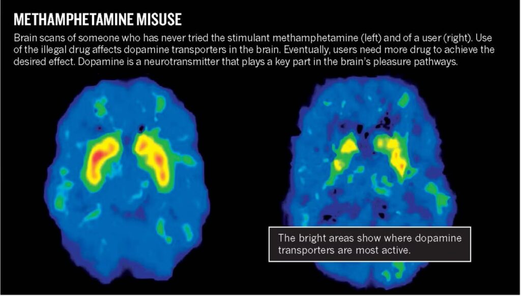Neuroplasticidad: Reconectando el Cerebro | iNeurociencias