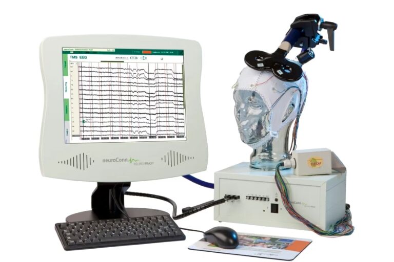 Estimulación Magnética Transcraneal: Guía Completa | iNeurociencias