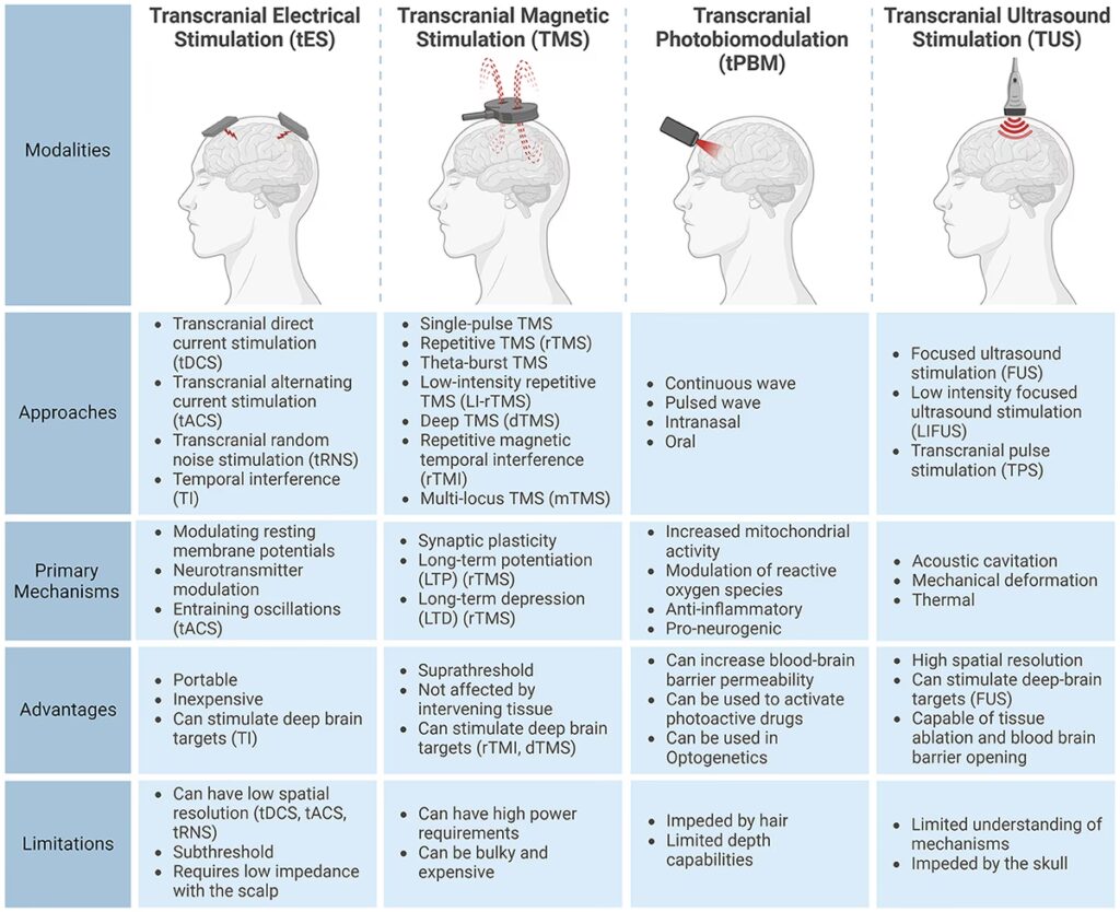 Estimulaci n Cerebral No Invasiva NIBS INeurociencias Estimulaci n Cerebral No Invasiva NIBS INeurociencias