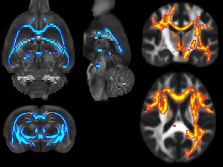 La Neuroplasticidad: El Poder del Cerebro Cambiante | iNeurociencias