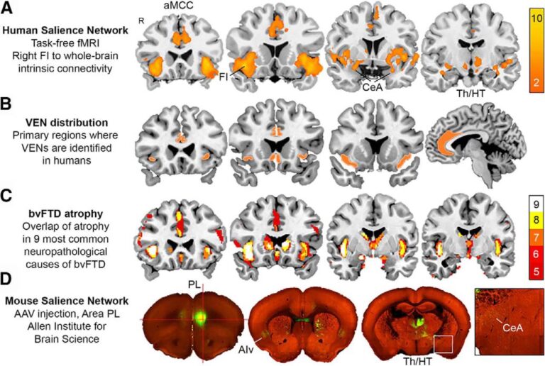 La Salencia: Qué Es y Cómo Influye en Tu Cerebro | iNeurociencias