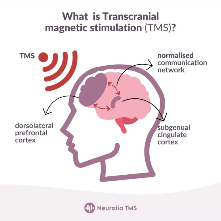 EMT y Neuroplasticidad: Transformando el Cerebro | iNeurociencias